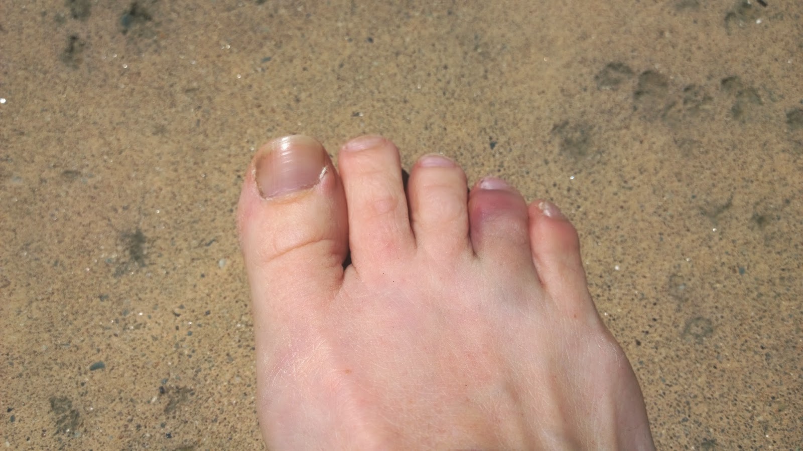 Juuret ja siivet: Musta varvas